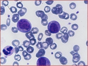 eritroblasti e cellule mieloidi immature: la Dr.ssa Maria Golato ci ...